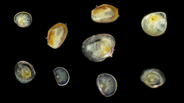 รูปภาพZooplankton – เลือกดูภาพถ่ายสต็อก เวกเตอร์ และวิดีโอ3,805 | Adobe ...
