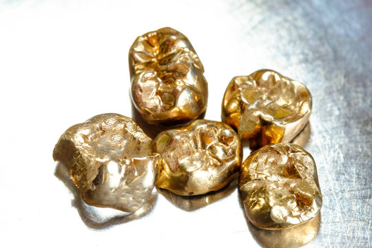 Zahngold Bilder – Durchsuchen 28,983 Archivfotos, Vektorgrafiken und ...