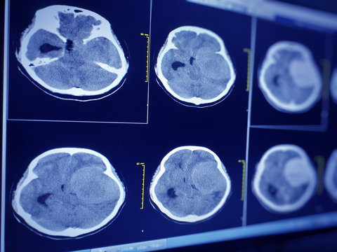 Lobulated Images – Browse 37 Stock Photos, Vectors, and Video | Adobe Stock