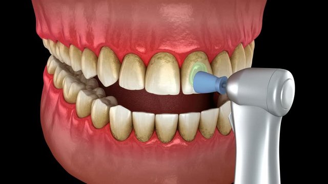 Prophylaxis Images – Browse 125,962 Stock Photos, Vectors, and Video ...