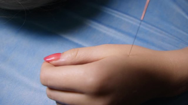 Dry Needling Images – Browse 44,100 Stock Photos, Vectors, and Video ...