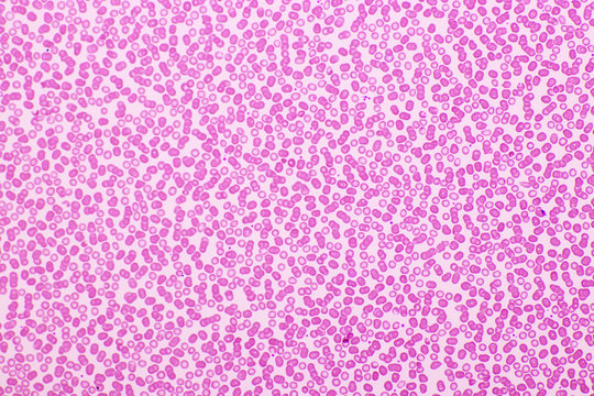 รูปภาพGiemsa – เลือกดูภาพถ่ายสต็อก เวกเตอร์ และวิดีโอ227 | Adobe Stock