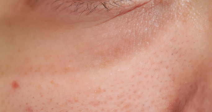 รูปภาพEyebags – เลือกดูภาพถ่ายสต็อก เวกเตอร์ และวิดีโอ263 | Adobe Stock