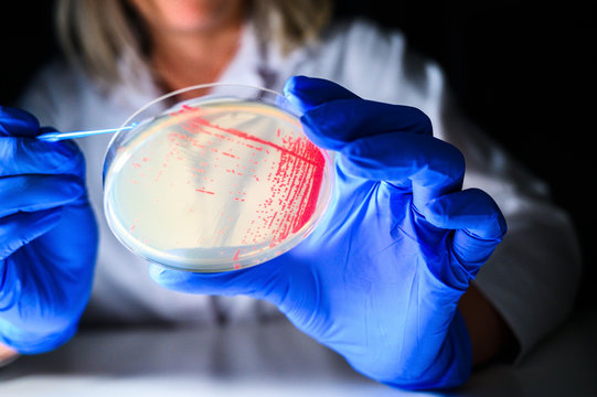 Microbal Bilder – Durchsuchen 81 Archivfotos, Vektorgrafiken und Videos ...