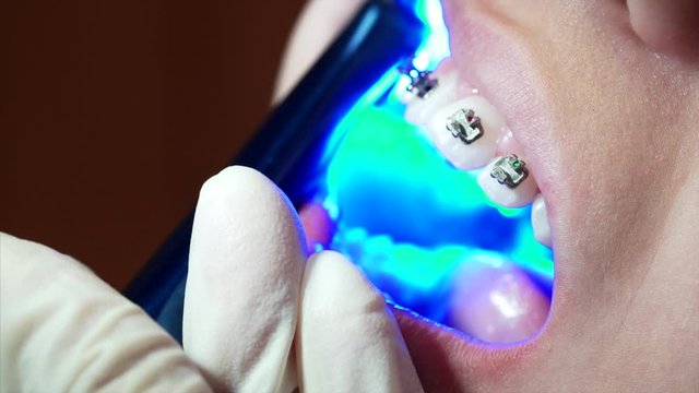 Obrázky Orthodontal – procházejte fotografie, vektory a videa 1,469 ...