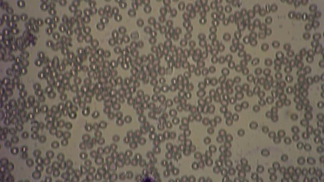 Smear Under Microscope Images – Browse 865 Stock Photos, Vectors, and ...