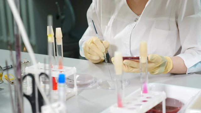 Antibiogram Images – Browse 60 Stock Photos, Vectors, and Video | Adobe ...