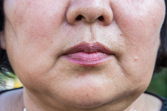 รูปภาพSnub-Nosed – เลือกดูภาพถ่ายสต็อก เวกเตอร์ และวิดีโอ5,934 | Adobe ...