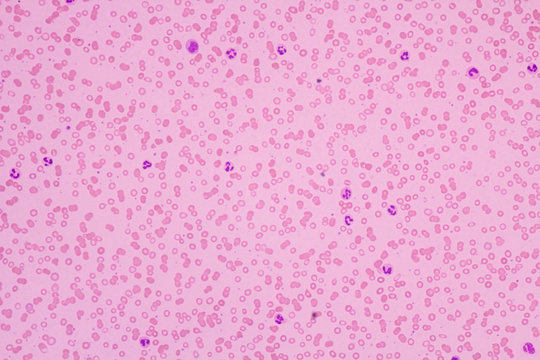 รูปภาพGranulocyte – เลือกดูภาพถ่ายสต็อก เวกเตอร์ และวิดีโอ1,757 | Adobe ...