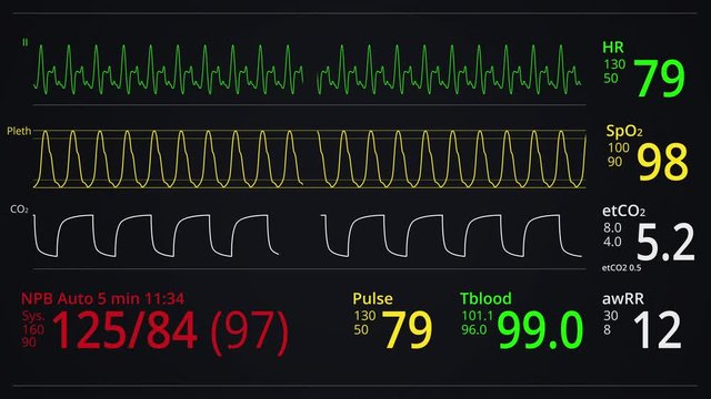 "Heart Rate Monitor" Images – Browse 10,114 Stock Photos, Vectors, and ...