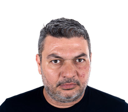 Beat Up Face Bilder – Durchsuchen 19,289 Archivfotos, Vektorgrafiken ...