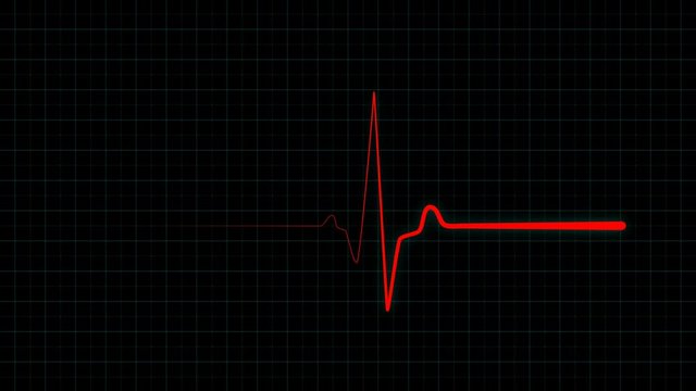 Ekg Flatline Images – Browse 343 Stock Photos, Vectors, and Video ...