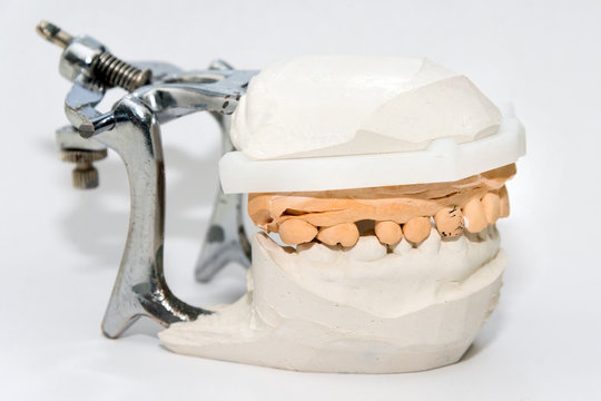 「Orthodontal」の画像 - 1,463 件の Stock 写真、ベクターおよびビデオ | Adobe Stock