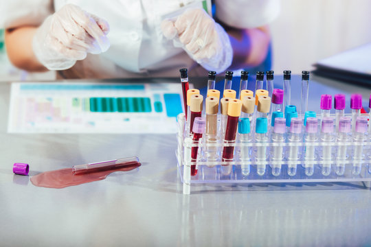 รูปภาพ"Laboratory Accident" – เลือกดูภาพถ่ายสต็อก เวกเตอร์ และวิดีโอ608 ...