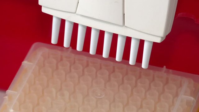 Eppendorf Video Footage – Browse 116 HD Stock Video and Footage | Adobe ...