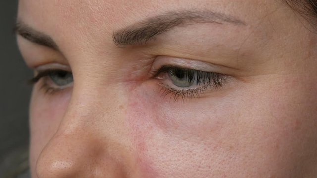 Angioedema Images – Browse 449 Stock Photos, Vectors, and Video | Adobe ...