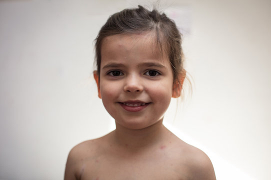 Waterpox Bilder – Durchsuchen 102 Archivfotos, Vektorgrafiken und ...