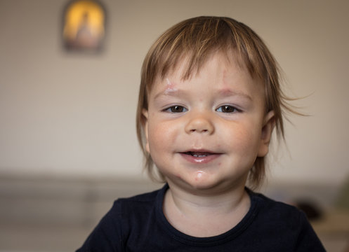 Waterpox Képek – Böngésszen 102 stockfotókat, vektorokat és videókat ...