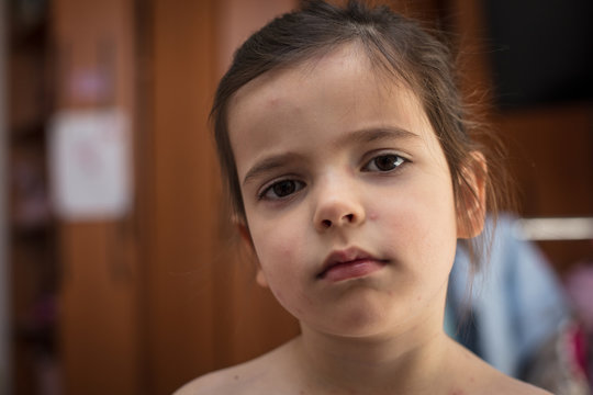 Imagens de Waterpox – Explore Fotografias do Stock, Vetores e Vídeos de ...