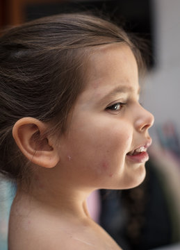 รูปภาพWaterpox – เลือกดูภาพถ่ายสต็อก เวกเตอร์ และวิดีโอ111 | Adobe Stock