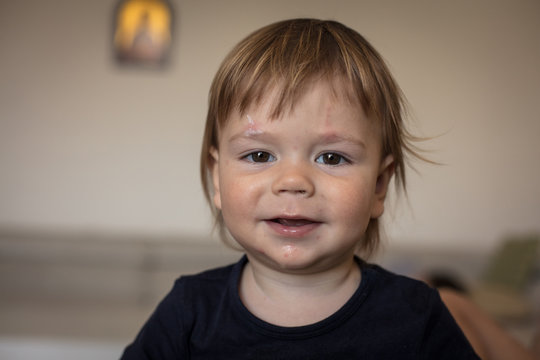 Waterpox Bilder – Durchsuchen 102 Archivfotos, Vektorgrafiken und ...