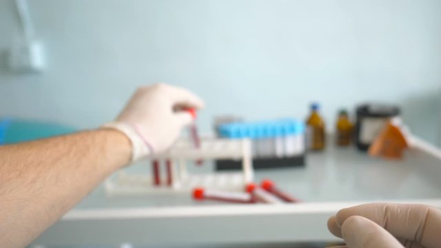 "Blood Sample" Images – Browse 522 Stock Photos, Vectors, and Video ...