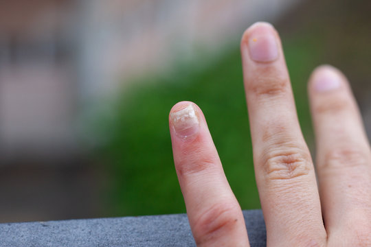 Slatternly Bilder – Durchsuchen 949 Archivfotos, Vektorgrafiken und ...