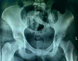 Pubis : photos, illustrations, vecteurs et vidéos libres de droits ...