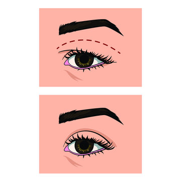 Blepharon Images – Browse 39 Stock Photos, Vectors, and Video | Adobe Stock