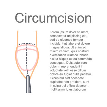 รูปภาพPrepuce – เลือกดูภาพถ่ายสต็อก เวกเตอร์ และวิดีโอ522 | Adobe Stock