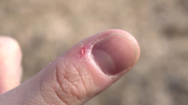 Unguises-Bilder: Stock-Fotos & -Videos. | Adobe Stock