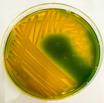 Tcbs Billeder – Gennemse 37 stockfotos, vektorer og videoer | Adobe Stock