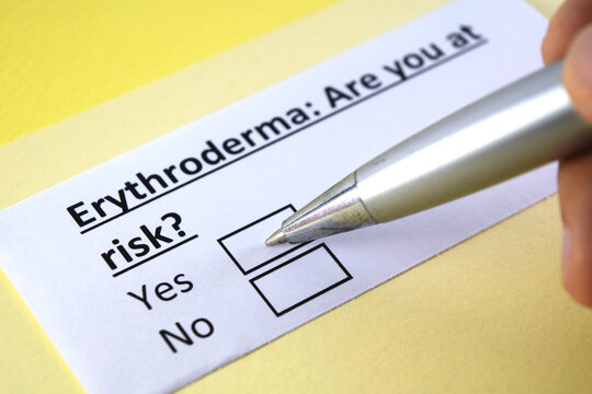 Erythroderma Images – Browse 53 Stock Photos, Vectors, and Video ...