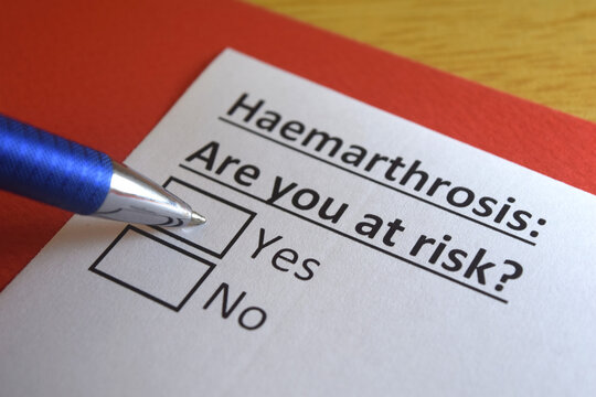 Hemarthrosis Images – Browse 96 Stock Photos, Vectors, and Video ...