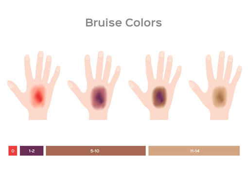 Hickey Images – Browse 282 Stock Photos, Vectors, and Video | Adobe Stock