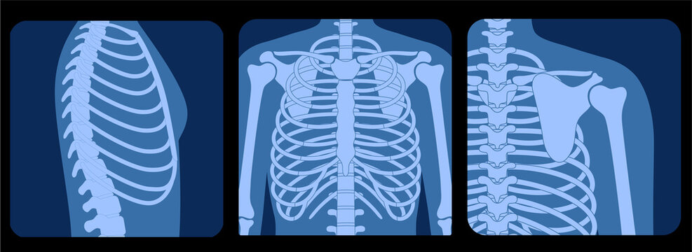 Abdomen X Ray Templates – Free Editable Designs | PikWizard