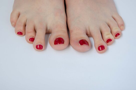 Long Red Toenails