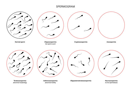 Spermogram bilder – Bläddra bland 306 stockfoton, vektorer och videor ...