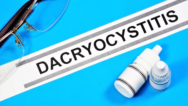 Dacryocystitis Images – Browse 54 Stock Photos, Vectors, and Video ...