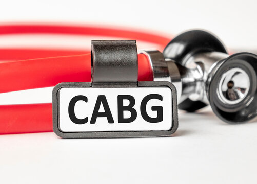 รูปภาพCabg – เลือกดูภาพถ่ายสต็อก เวกเตอร์ และวิดีโอ749 | Adobe Stock