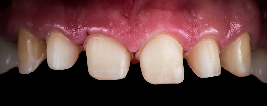 Venner Images – Browse 268 Stock Photos, Vectors, and Video | Adobe Stock