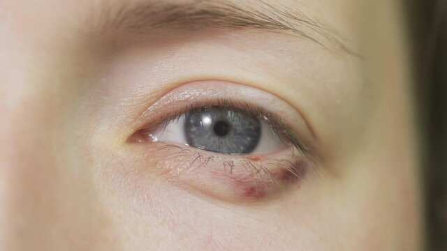 Meibom Bilder – Durchsuchen 32 Archivfotos, Vektorgrafiken und Videos ...