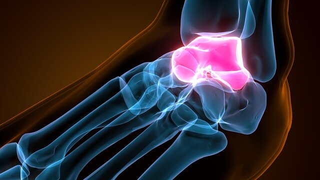 "Talus Bone" Images – Browse 10,668 Stock Photos, Vectors, and Video ...