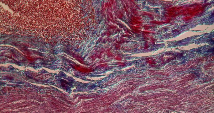 Gaumenmandeln Bilder – Durchsuchen 323 Archivfotos, Vektorgrafiken und ...