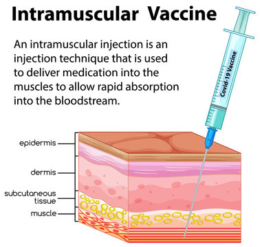 รูปภาพIntramuscular – เลือกดูภาพถ่ายสต็อก เวกเตอร์ และวิดีโอ7,788 ...
