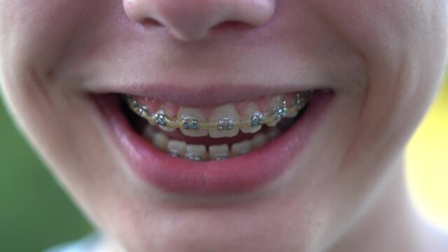 Snaggletooth Images – Browse 101 Stock Photos, Vectors, and Video ...