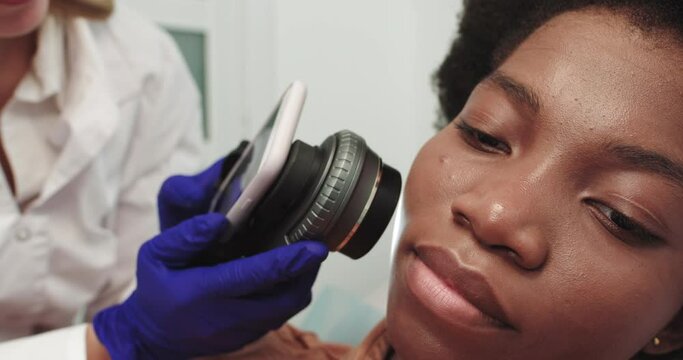 Dermoscopy Images – Browse 1,781 Stock Photos, Vectors, and Video ...