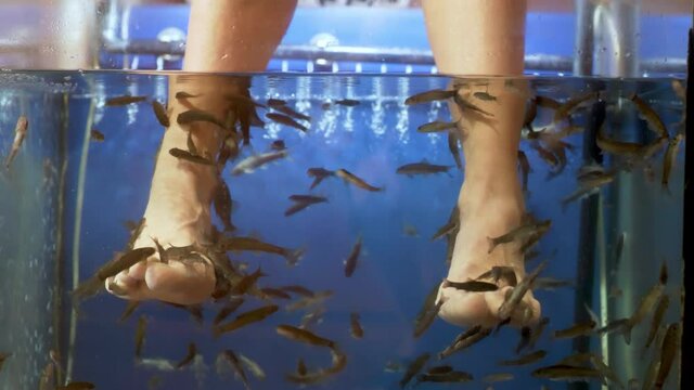 Name That Fish Eat Dead Skin