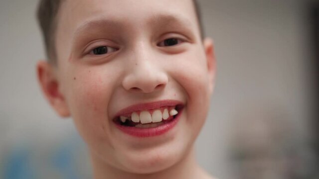 รูปภาพ"Loose Tooth" – เลือกดูภาพถ่ายสต็อก เวกเตอร์ และวิดีโอ325 | Adobe ...