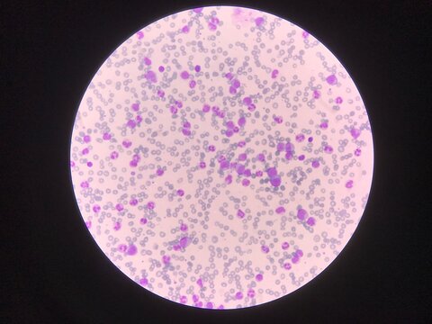 รูปภาพMetamyelocyte – เลือกดูภาพถ่ายสต็อก เวกเตอร์ และวิดีโอ142 | Adobe ...